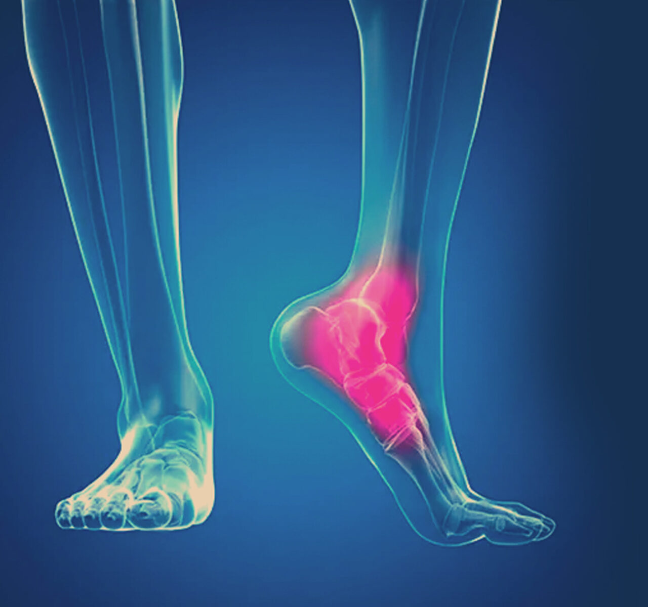 Magnetröntgen fotled (MR fotled) – boka utan remiss