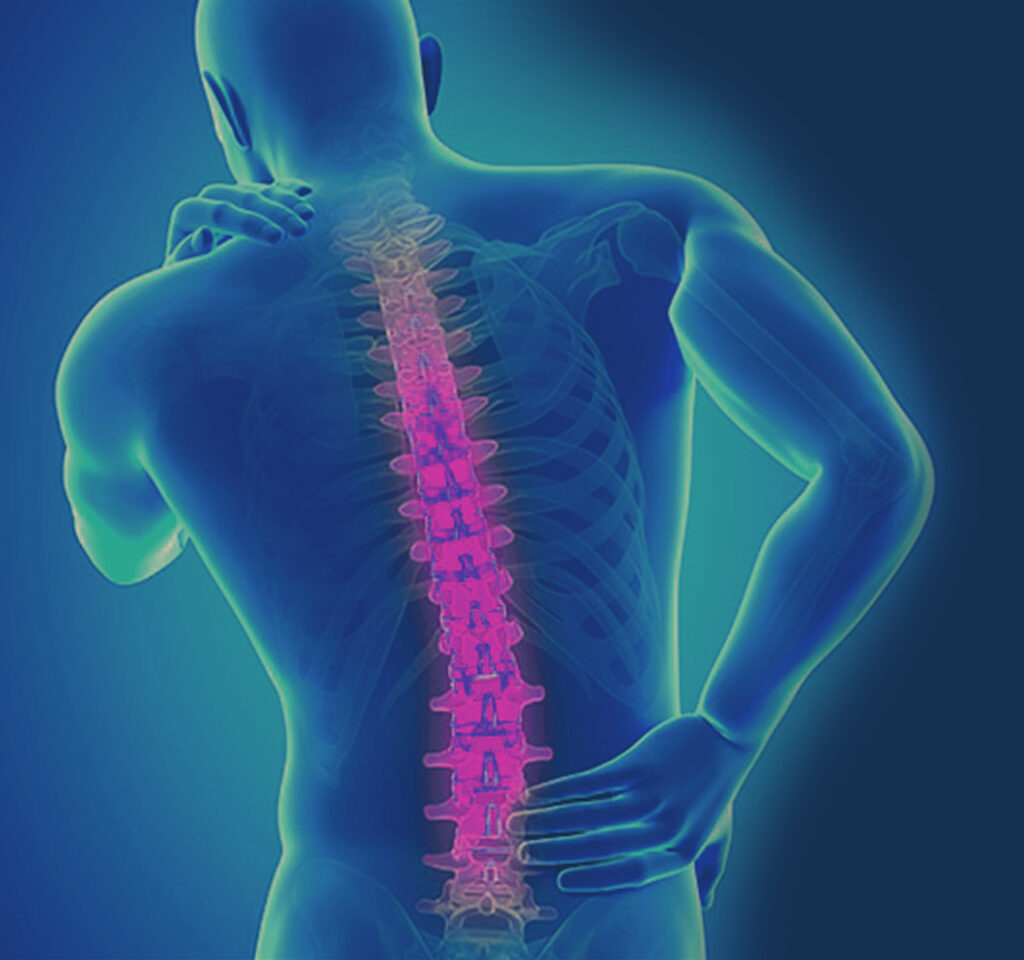 Magnetröntgen helrygg (MR helrygg) – boka utan remiss